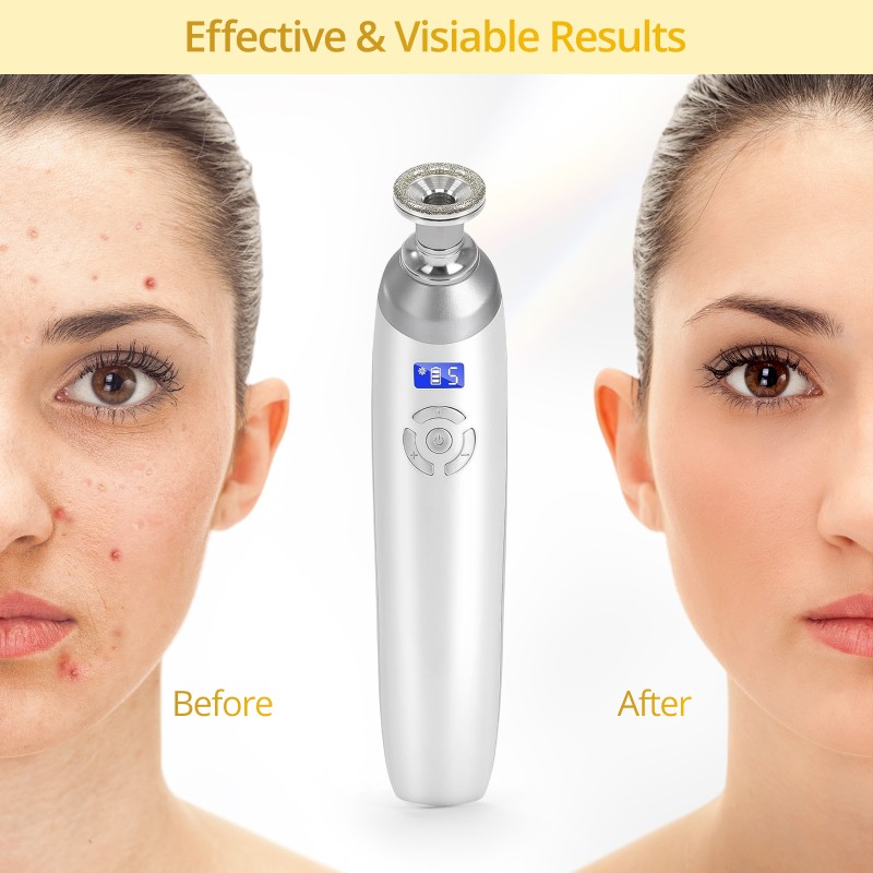 Diamond Microdermabrasion Device With 9 Diamond Tips