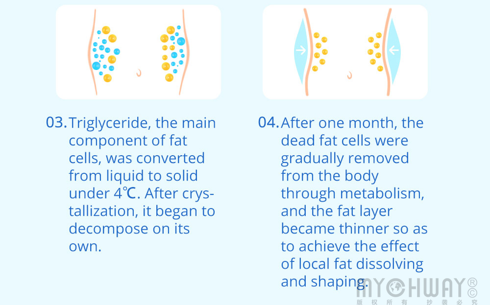 Cool Technology selectively targets fat bulges and eliminates fat cells ...