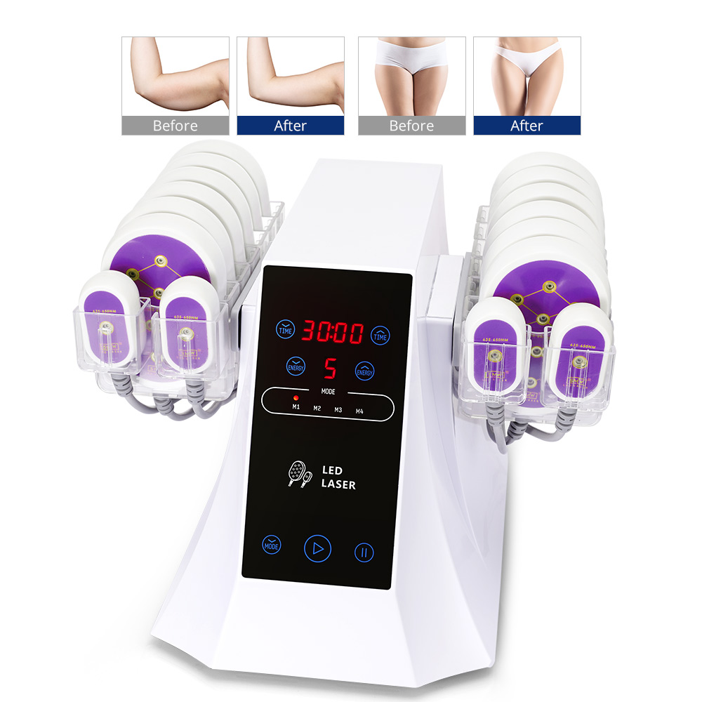Comparison of several types of slimming machines helping women to ...