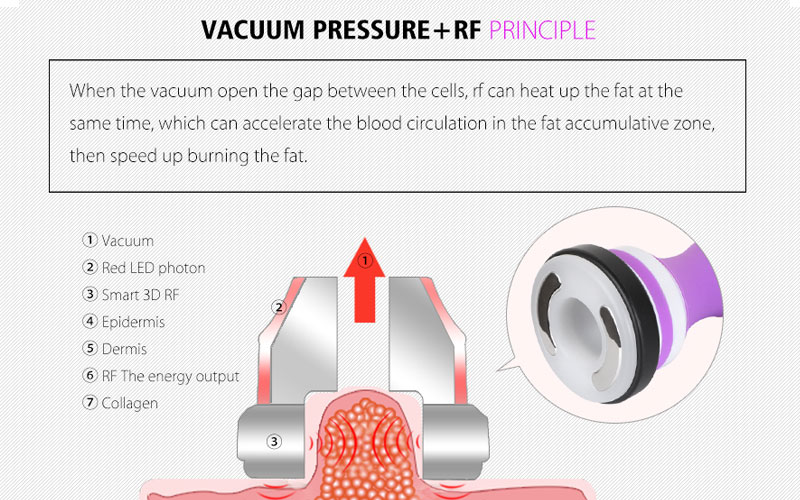 Best Cooled Radio Frequency Treatment For You